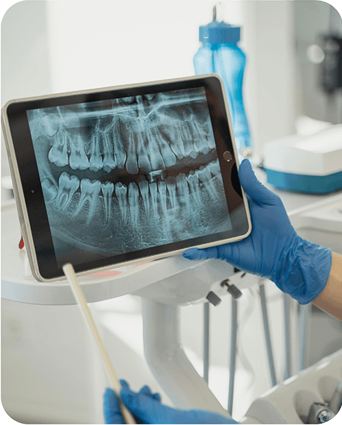 Compassionate Release of Super | Super for Health